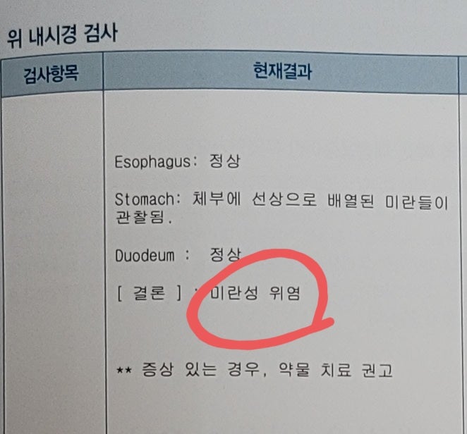 미란성위염 증상 원인 죽순이 시작 편의점 죽 11 쓸어오다 네이버 블로그