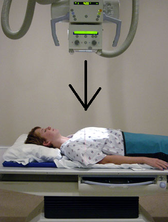 Chest x-ray(Chest PA, AP, Lateral, decubitus) : 네이버 블로그