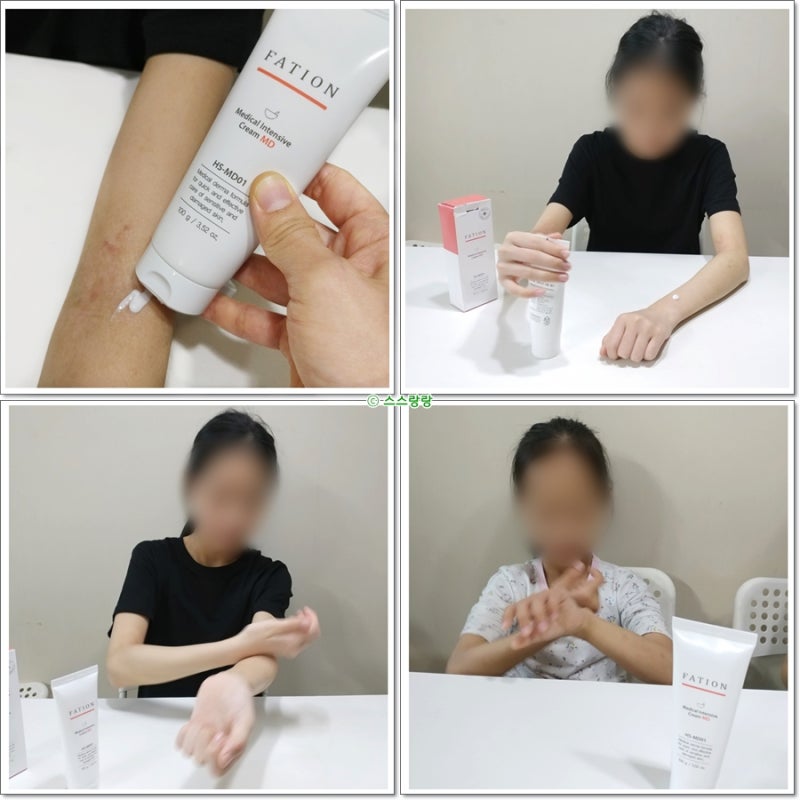 스테로이드 없이 손상된 피부 장벽을 보호하는 파티온 메디컬 인텐시브 크림 Md 네이버 블로그