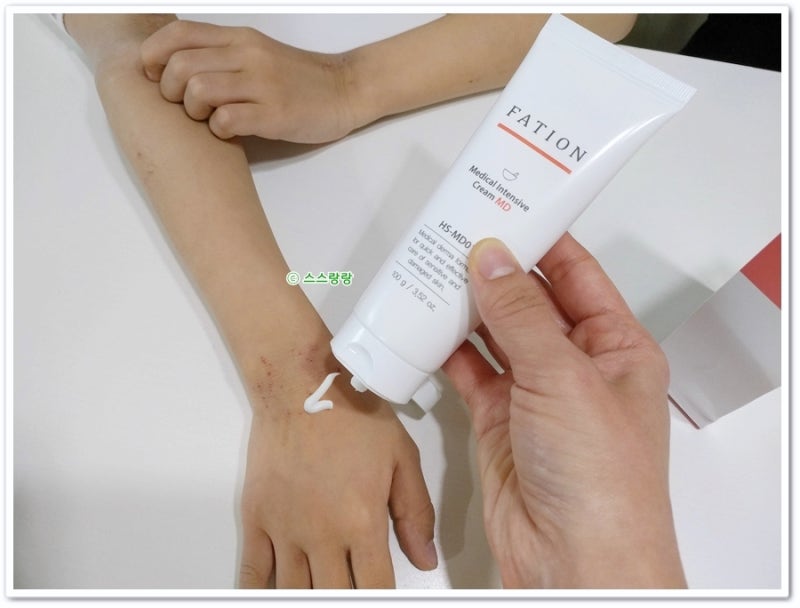 스테로이드 없이 손상된 피부 장벽을 보호하는 파티온 메디컬 인텐시브 크림 Md 네이버 블로그