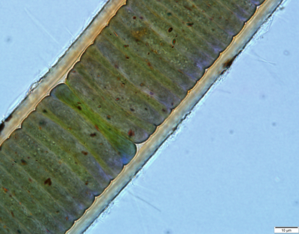 눈에 보이는 원핵생물, 남조류 마이크로세이라 : 네이버 블로그