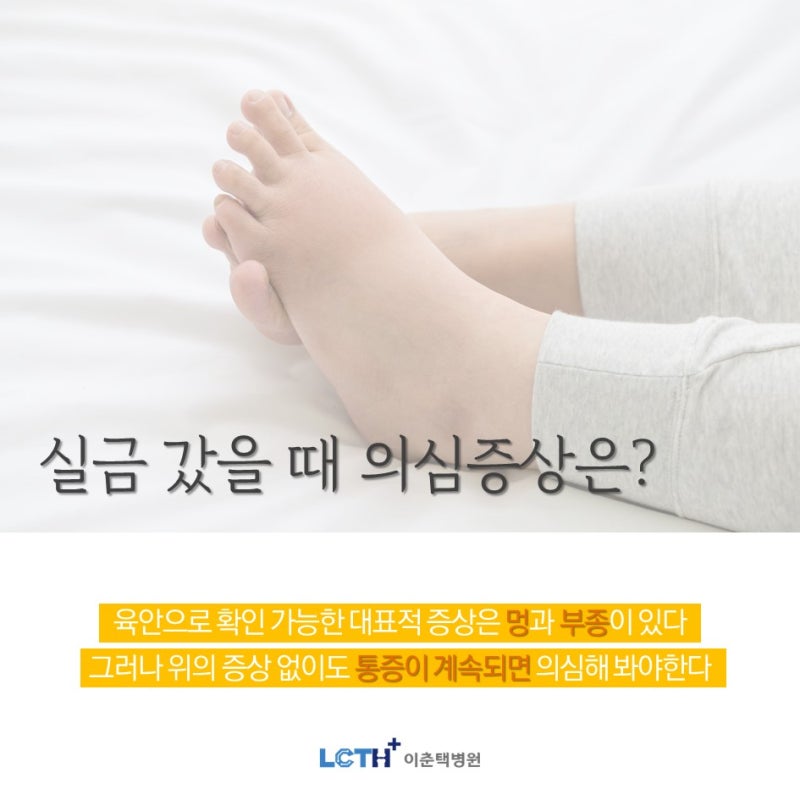 뼈에 실금미세골절 확인하려면 X Ray Ct Mri 어떤 촬영을 해야 할까 수원 정형외과 이춘택병원 네이버 블로그