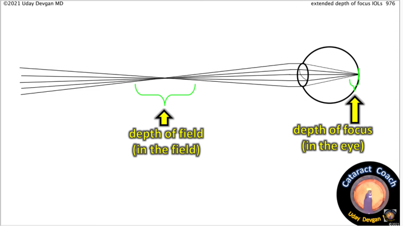 [인공수정체] Vivity EDOF IOL와 Panoptix multifocal IOL : 네이버 블로그
