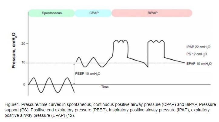 NIV(BIPAP), non-invasive ventilation 비침습적환기 : 네이버 블로그