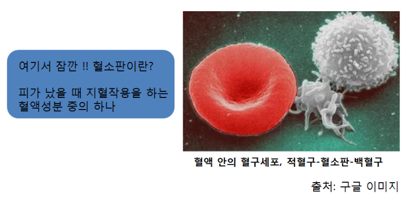 코로나 백신 부작용 혈전 원인 증상 검사 치료는 혈소판 감소성 혈전증 아스트라제네카 얀센 혈전 멍 두통