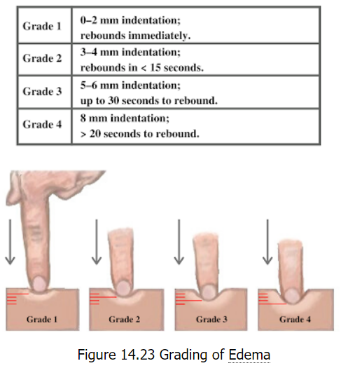 Swelling, Edema, Effusion 모두 부종?인가 차이가 있을까? 왜 다르게 쓸까 : 네이버 블로그