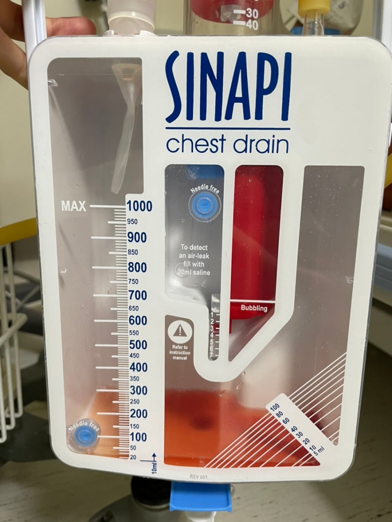 Pneumothorax(기흉), CTD bottle 종류 : 네이버 블로그