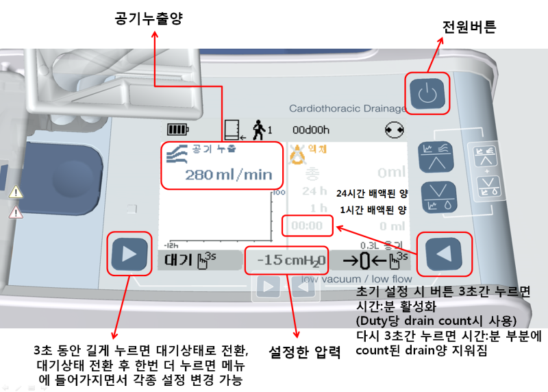 Pneumothorax(기흉), CTD bottle 종류 : 네이버 블로그