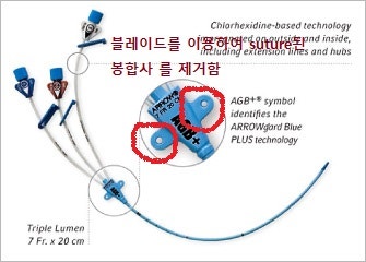쭈이와 간호공부:) C-line, PICC, HD cath 각종 카테터 종류와 간호 : 네이버 블로그