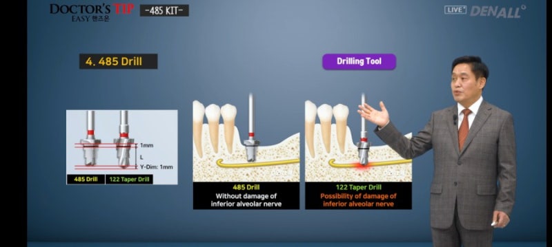 [덴올] 485kit & one 485 kit - 김경원 원장님 : 네이버 블로그