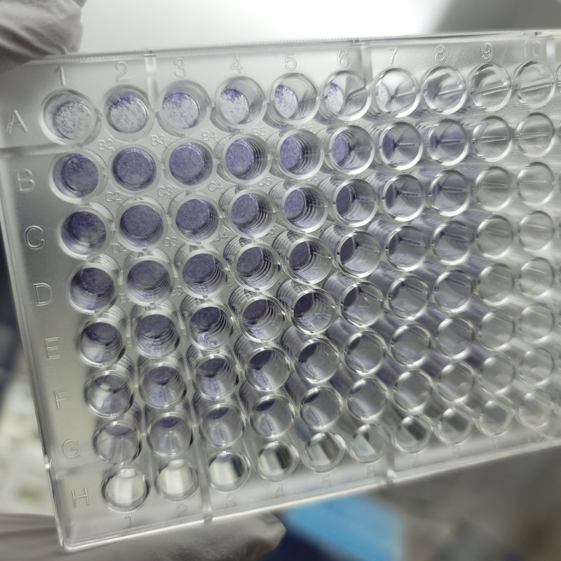 [LAB파토리 #3] 세포 독성 Test / MTT Assay : 네이버 블로그