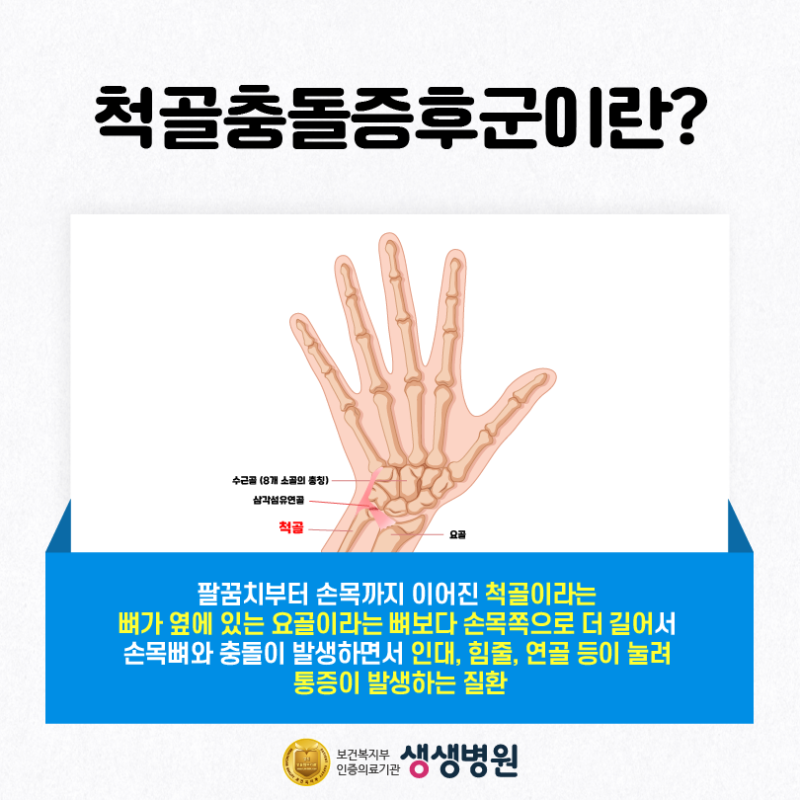 손목뼈 돌출 새끼손가락 저림 손목 바깥쪽 통증 원인 척골충돌증후군 네이버 블로그