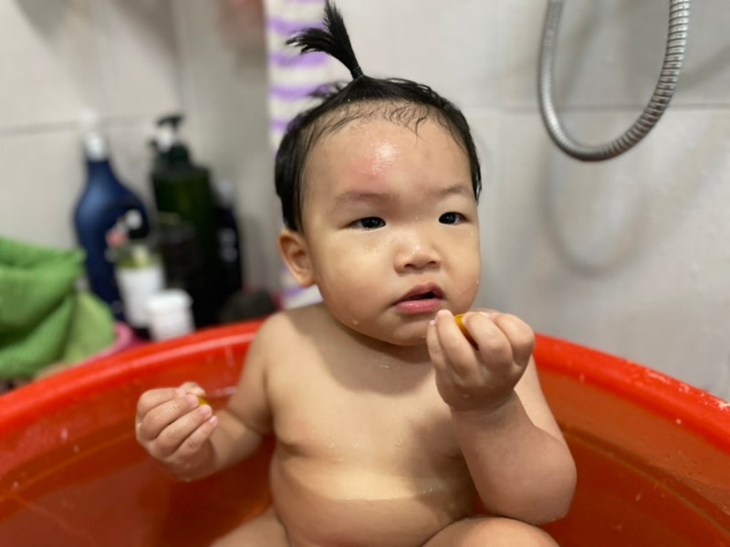 아기 모기물렸을때 리도맥스연고 냉찜질메디폼열패치 결국 병원 리얼후기 네이버 블로그