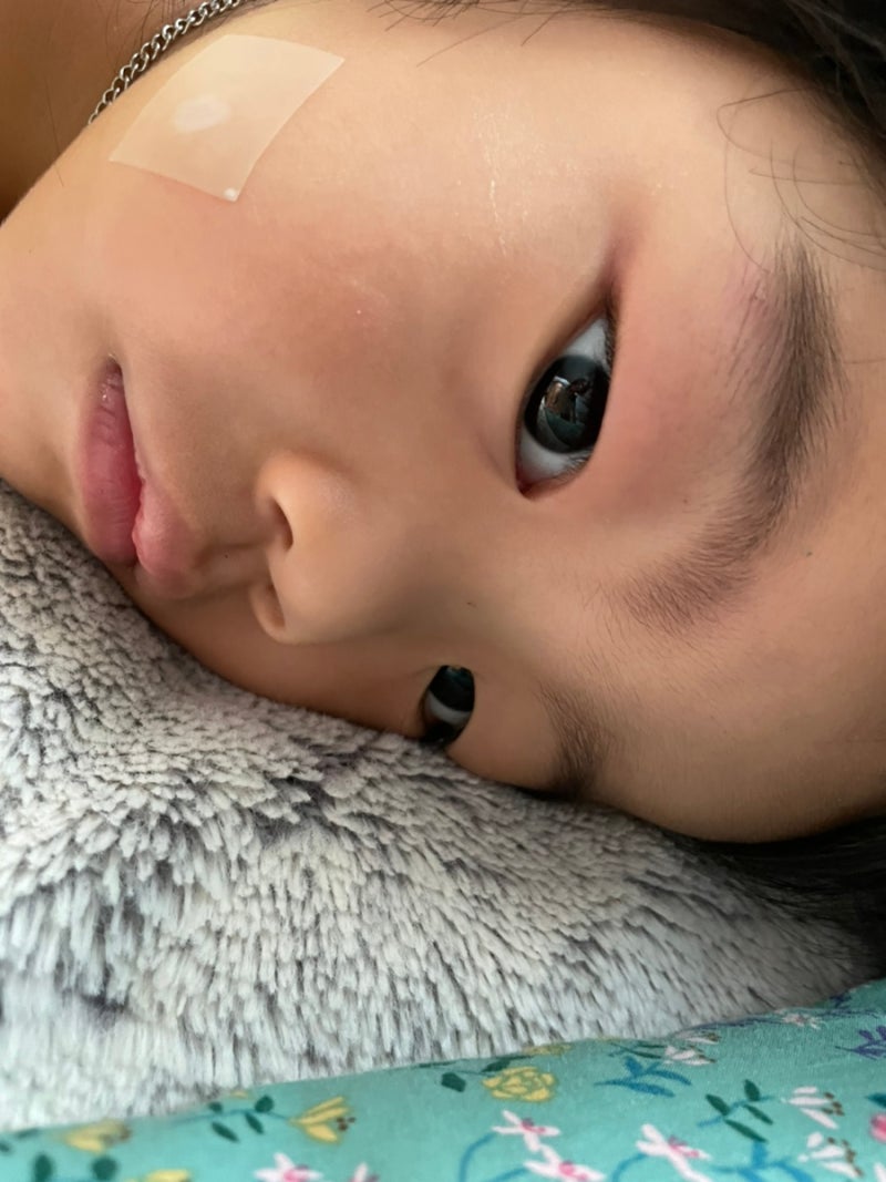 아기 모기물렸을때 리도맥스연고 냉찜질메디폼열패치 결국 병원 리얼후기 네이버 블로그