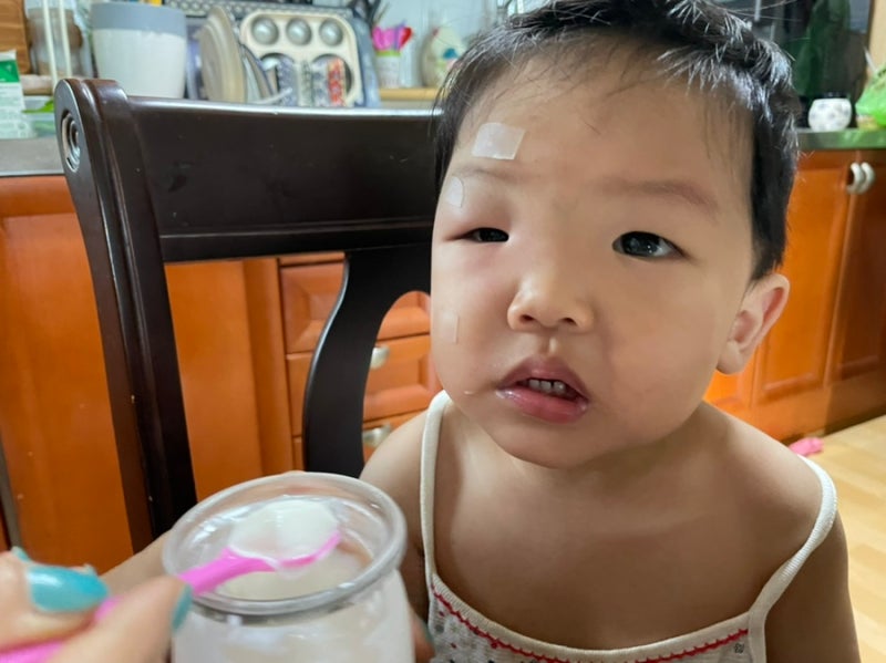 아기 모기물렸을때 리도맥스연고 냉찜질메디폼열패치 결국 병원 리얼후기 네이버 블로그