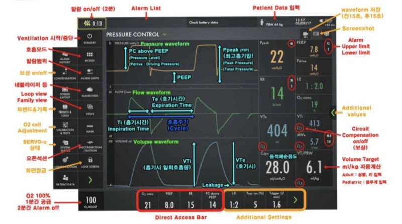 Ventilator 알람, 용어, mode, PBW (servo-i, servo-air) : 네이버 블로그