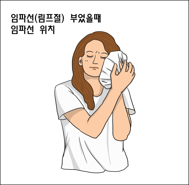 임파선 부었을때 림프절 위치 임파절은 면역의 휴식 공간 네이버 블로그