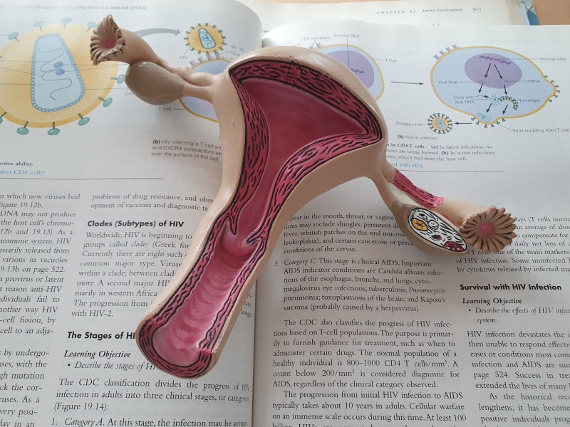 ASCUS는 무슨 의미인가요? : 네이버 블로그