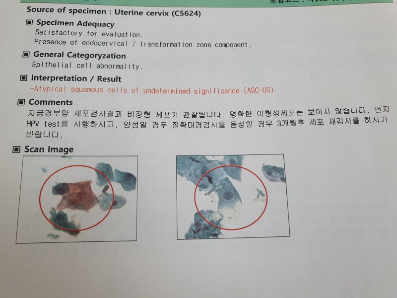 ASCUS는 무슨 의미인가요? : 네이버 블로그