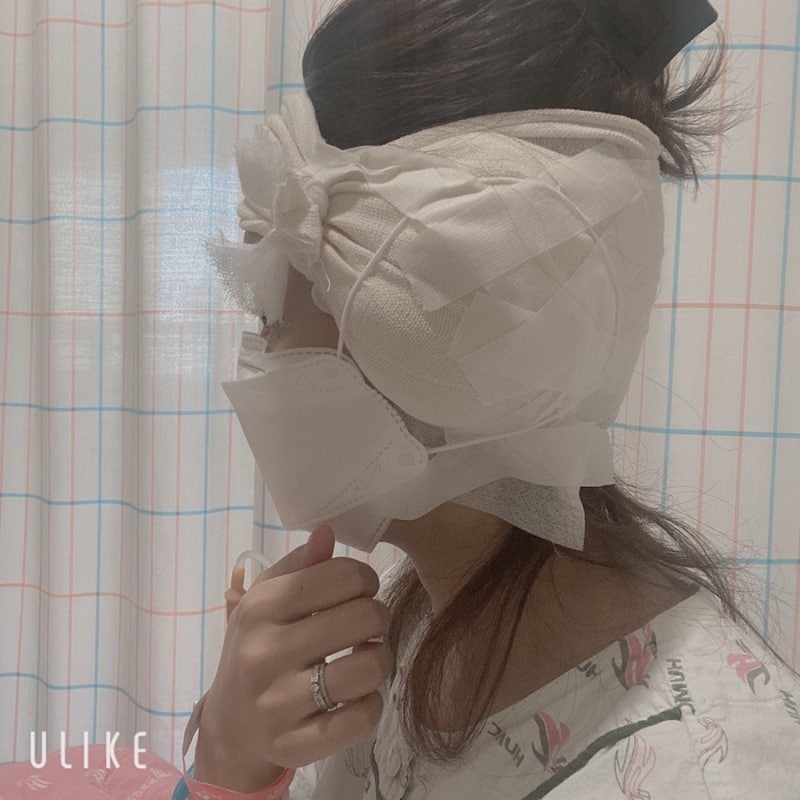 고막천공 고막성형술 입원3일차 퇴원합니다 고막천공수술비 네이버 블로그