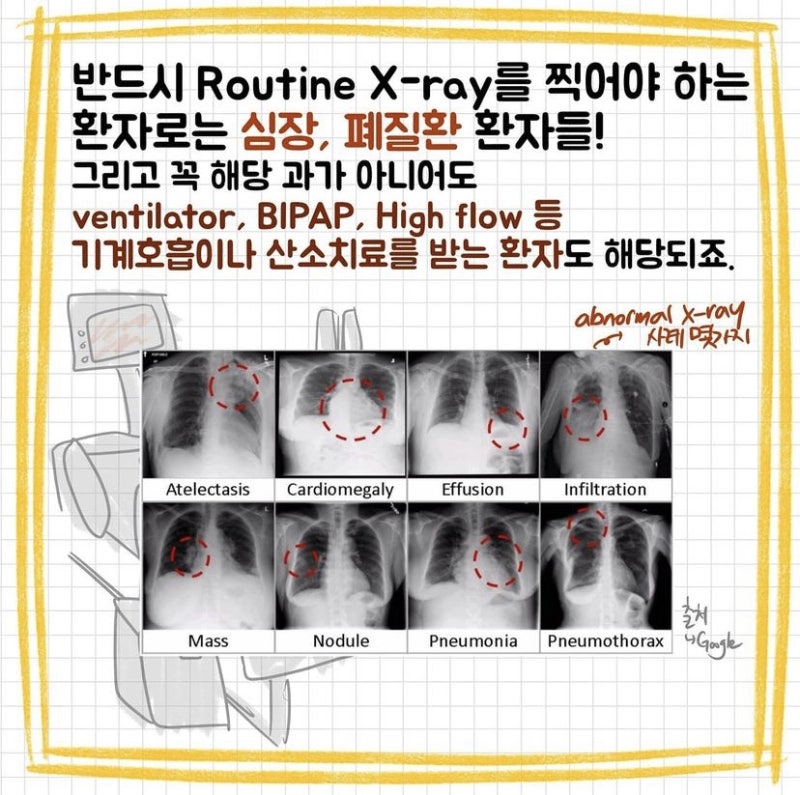 영상검사 영상의학과 검사와 종류 Ct와 Mri Mra 차이점 조영제 검사 네이버 블로그