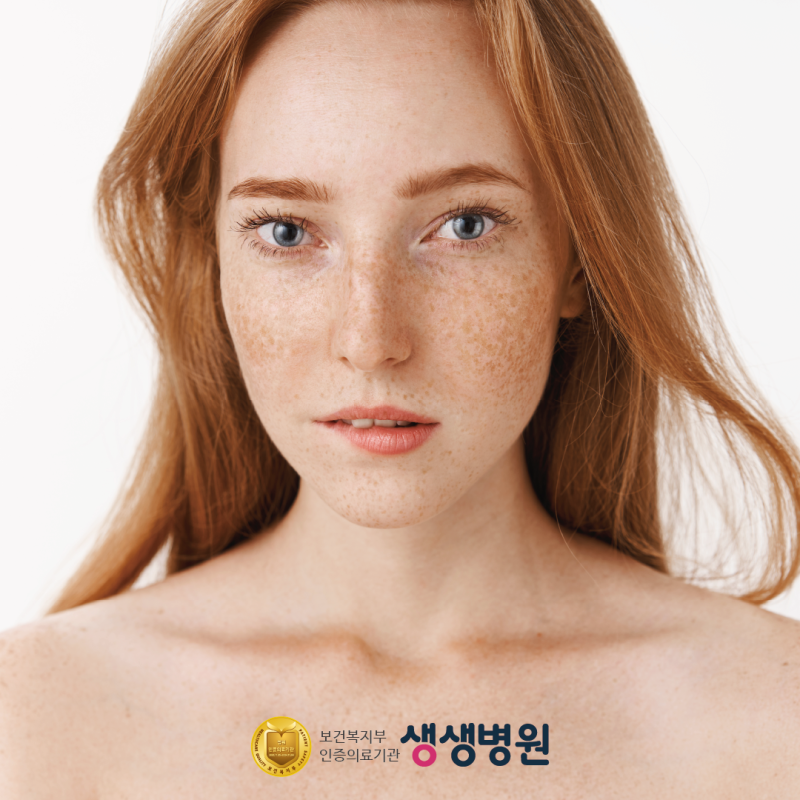 신경섬유종 밀크반점 밀크커피색 반점 유전병의 일종 신경섬유종증 네이버 블로그