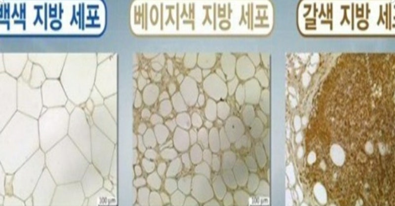 갈색지방조직 백색지방조직 베이지색지방세포 갈색지방 늘리는 방법 유니시티코리아 유여림 네이버 블로그