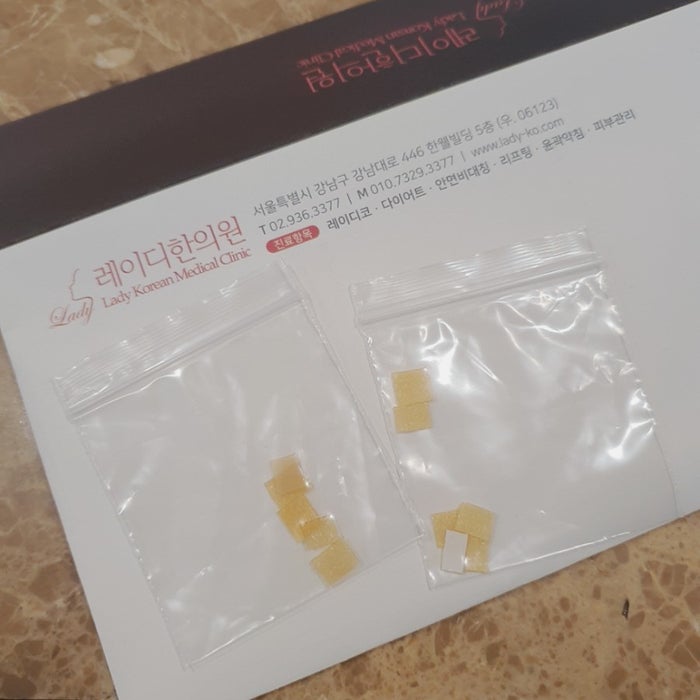 강남 민트실리프팅 멍x 붓기x 당일사진/ 얼굴형이 달라짐 / 브이라인 얼굴리프팅 추천! : 네이버 블로그