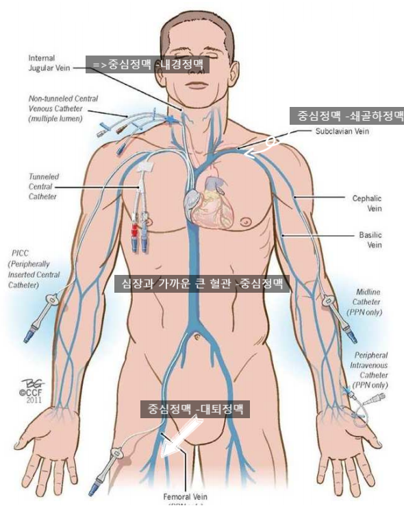 C Line 중심정맥관 삽입central Vein Catheterization중심정맥 카테터의 기본 1 삽입 위치