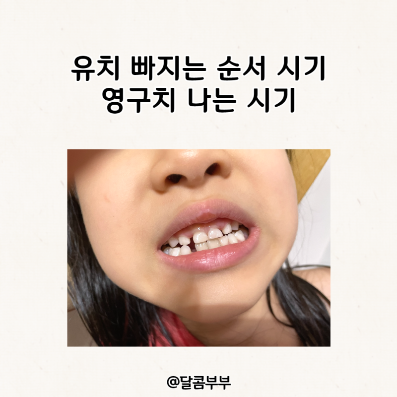 유치 빠지는 순서 시기영구치 나는 시기 알고 신경쓰기 네이버 블로그