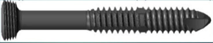 os수술 basic편 -screw에 대해 , reduction에 대해 , screw종류 , screw기능 , ORIF 아직 ...