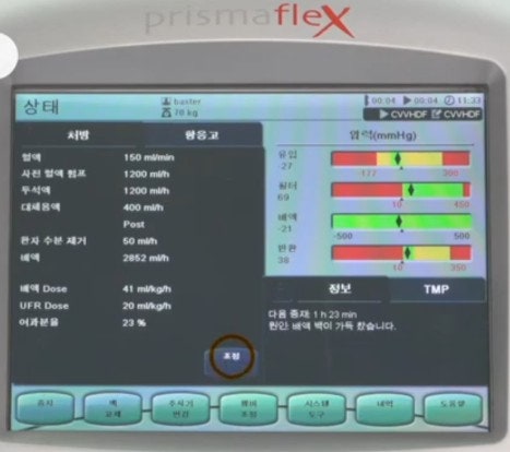 CRRT의 정의와 기계 priming 하는 방법, heparin 과 futhan 사용 방법 : 네이버 블로그