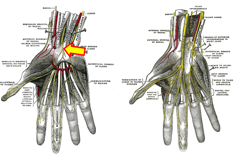 손끝저림손바닥저림 정중신경포착median Nerve Entrapment 천안아산 달천한의원 네이버 블로그