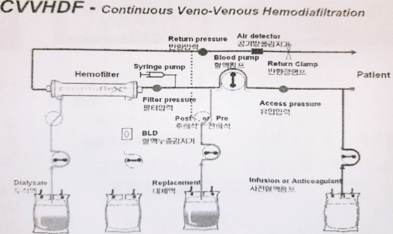 CRRT의 정의와 기계 priming 하는 방법, heparin 과 futhan 사용 방법 : 네이버 블로그