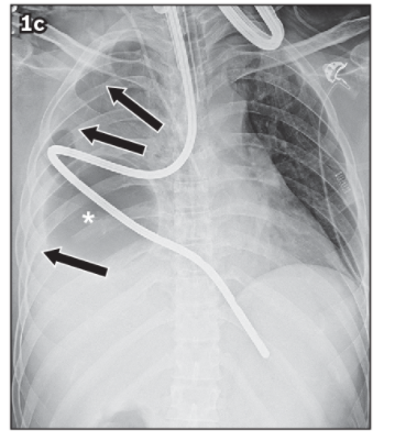 SB tube : 네이버 블로그