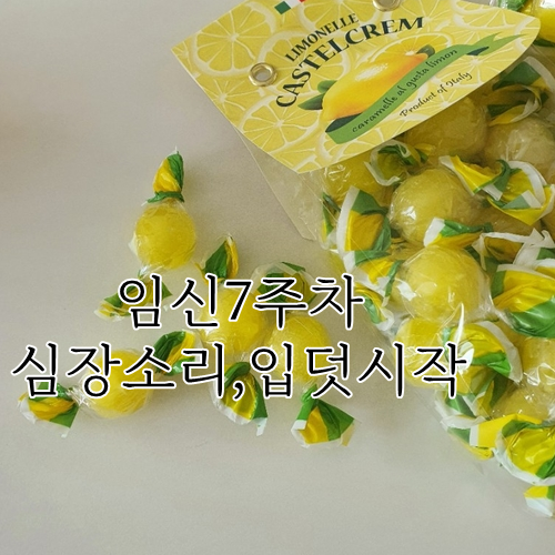 임신 7주차 초음파로 심장소리 확인 입덧 증상 시작 임신초기 출혈 네이버 블로그