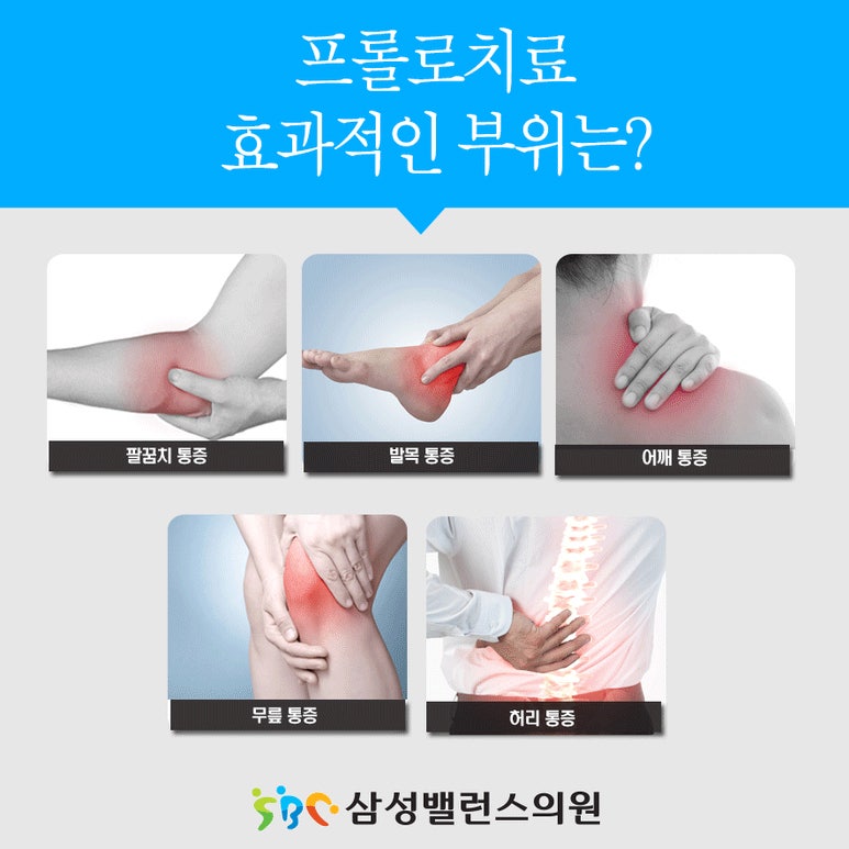 프롤로주사 치료의 모든 것 효과 성분 부작용 네이버 블로그