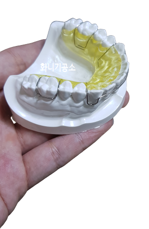 hawley retainer : 네이버 블로그