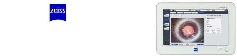 [포항안과 우리눈안과] 포항최초 ZEISS 칼리스토 아이(CALLISTO EYE) 도입 : 네이버 블로그