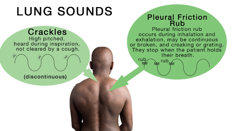 [호흡음/lung sounds] Crackles, Wheezing, Stridor, Rhonchi : 네이버 블로그