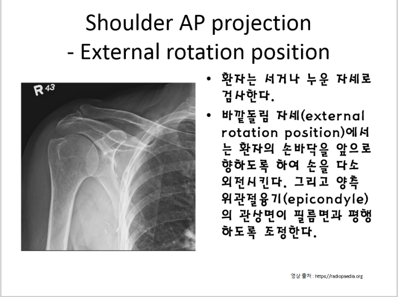 [일반촬영] 어깨 앞뒤 방향 촬영 - 바깥돌림자세 (Shoulder AP projection - External rotation ...