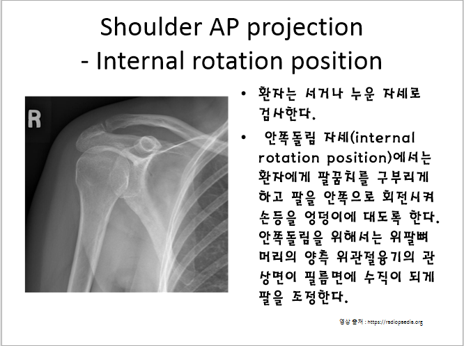 [일반촬영] 어깨 앞뒤방향 촬영 - 안쪽돌림자세 (Shoulder AP projection - Internal rotation ...