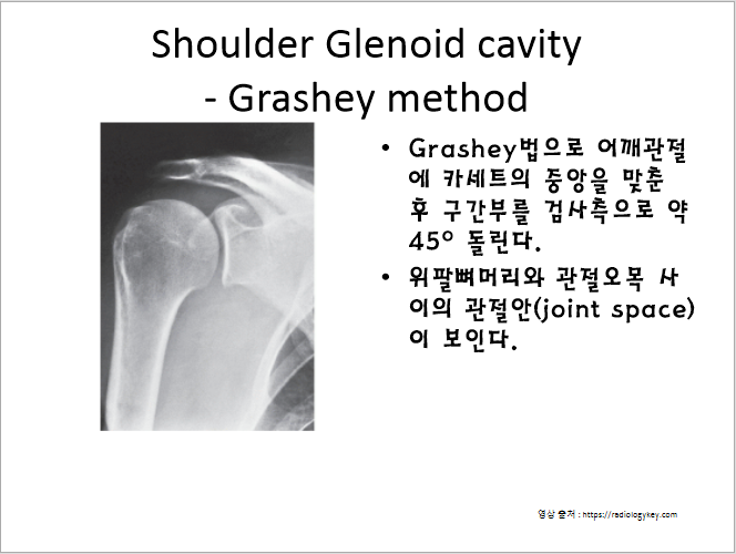 [일반촬영] 어깨 관절오목 - Grashey법 (Shoulder Glenoid cavity- Grashey method ...