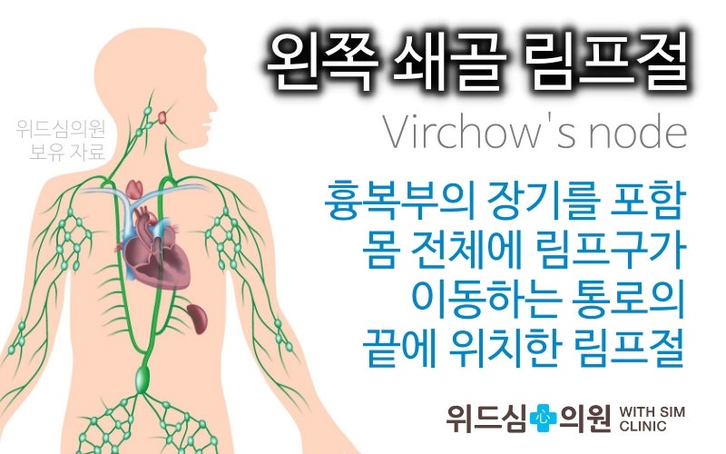 목 옆에 왼쪽 오른쪽 쇄골 임파선 목 멍울 정말로 위험한 위치일까요 목에 혹 병원 위드심의원 이비인후과 전문의
