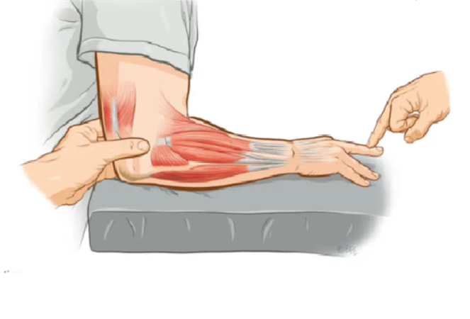 [테니스엘보 검사] 코젠검사(cozen's test) 밀검사(mill's test) 마우드슬리 검사(maudsley test ...