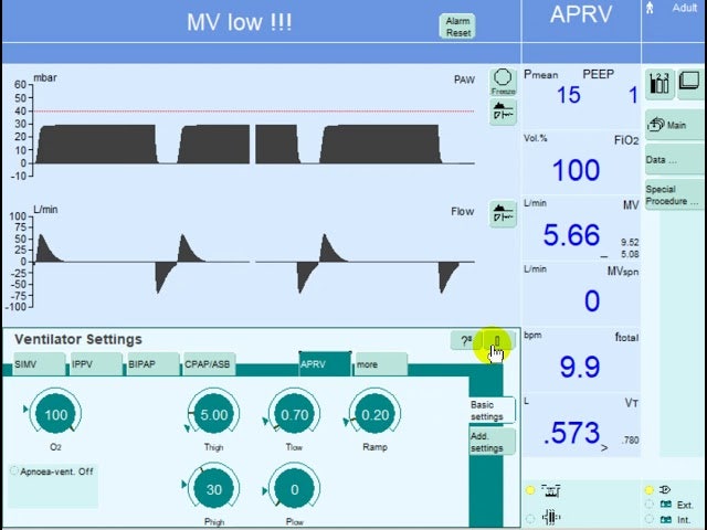 [mode] APRV : 네이버 블로그