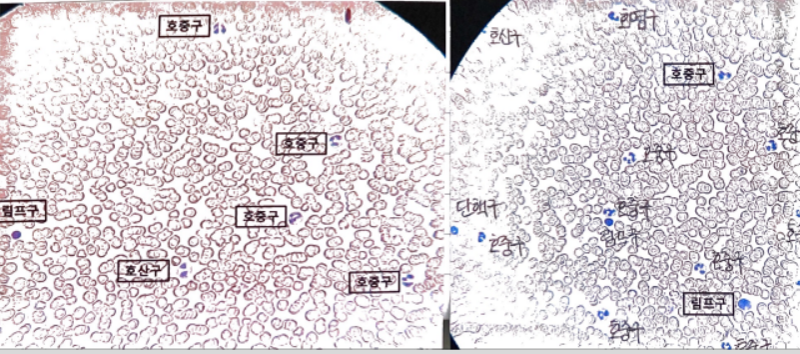 [일반생물학 실험노트] 혈구세포의 관찰 : 네이버 블로그