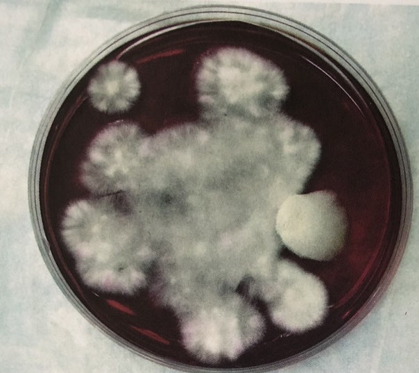 피부 사상균 검사 곰팡이 배지 배양 Dermatophyte Test Medium Fungal Cultures : 네이버 블로그