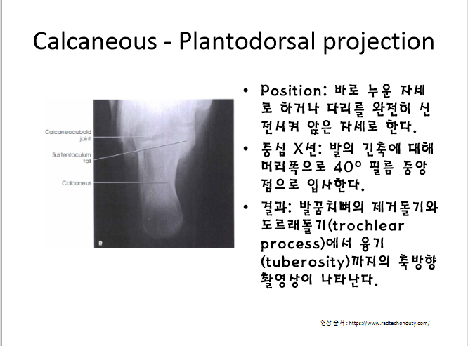 [일반촬영] 발꿈치뼈 뒤앞 축방향 촬영(Calcaneous - Plantodorsal projection) : 네이버 블로그