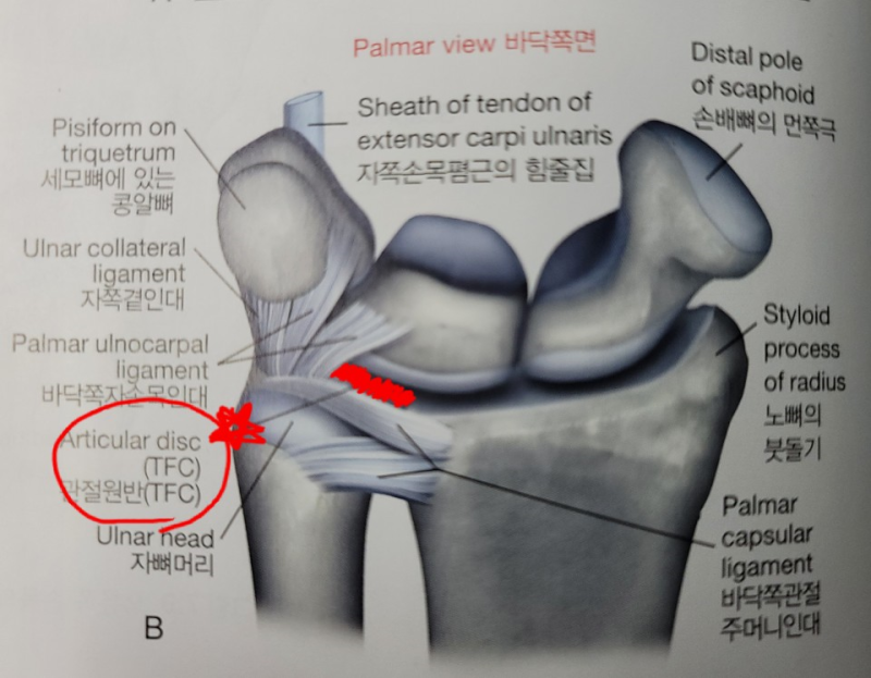 손목통증 삼각섬유연골복합체 손상이라는데 도대체 어디 네이버 블로그